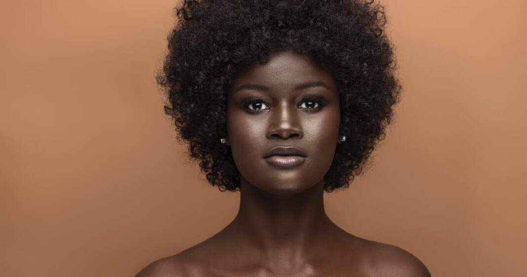 7 Charming People With Unusual Skin Conditions - WhatDeWhat