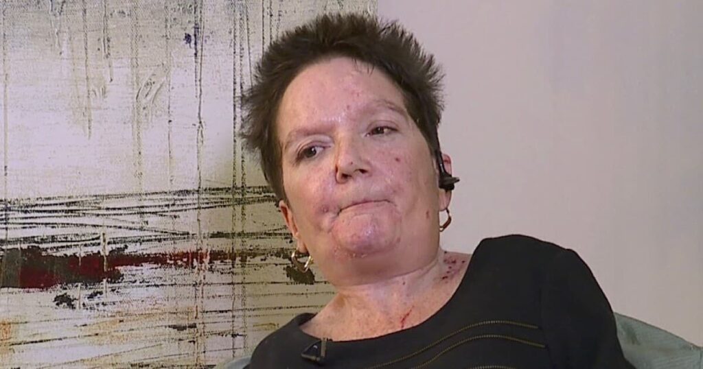 10 Strangest Medical Conditions You Don’t Want To Experience - WhatDeWhat